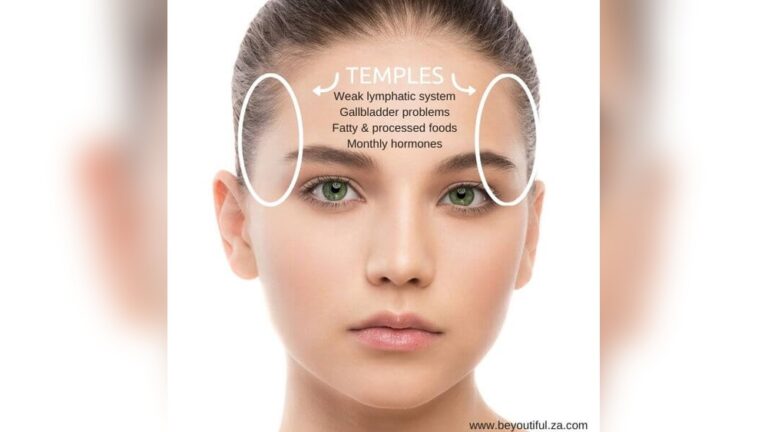 Why Do I Get Acne on Temples: Causes & Effective Solutions - Facial Adviser